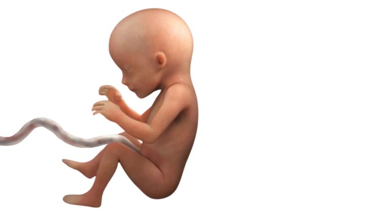 17th Week of Pregnancy - Assoc. Prof. Dr. Serkan Oral